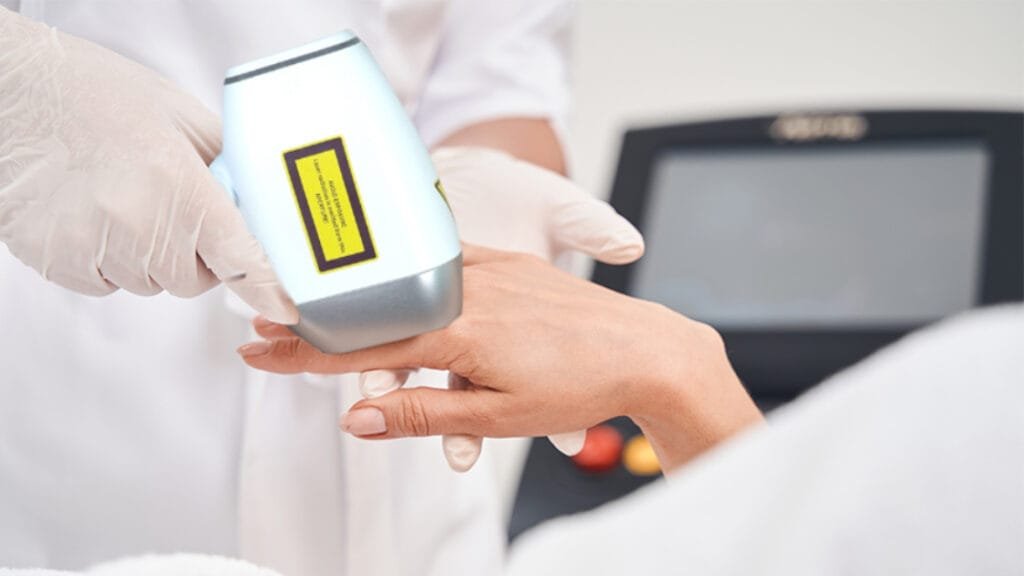 Smooth Knuckles Ahead: Will Diode Laser Hair Removal Work? - Rheinlaser ️
