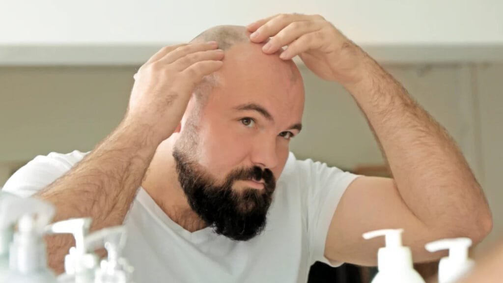 Smooth Scalp Ahead: Laser Hair Removal for a Bald Head - Rheinlaser ️