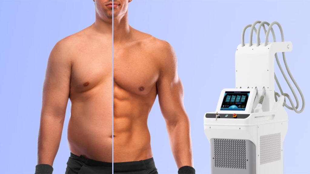PowerSculp: Revolutionizing Body Sculpting with Precision - Rheinlaser ️