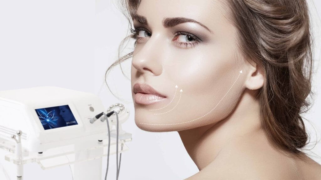 Transform Your Smile: RF Therapy for Marionette Lines - Rheinlaser ️