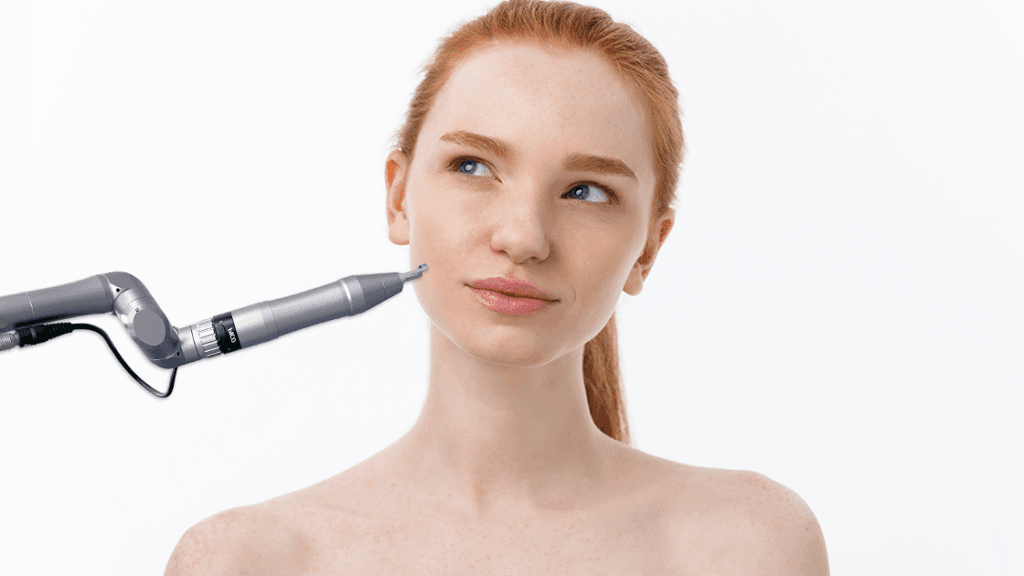 Revive Your Skin After Winter: Pico Laser Rejuvenation - Rheinlaser ️